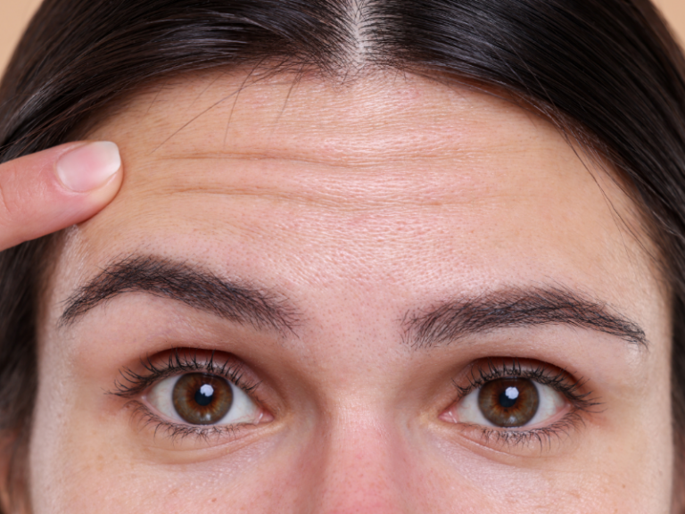 7 Simple Ways To Prevent Sleep Wrinkles
